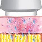 Lumicell Wave 6 - EstetikMed.ro